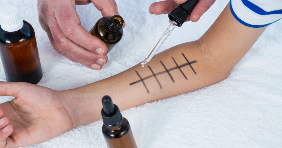 At-Home Allergy Testing | Florida Sinus & Snoring Specialists